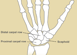 Understanding Scaphoid Fractures: Causes, Symptoms, and Treatment - Dr ...
